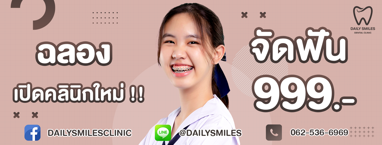 Daily Smiles Dental Clinic - ทำฟัน จัดฟัน ขอนแก่น